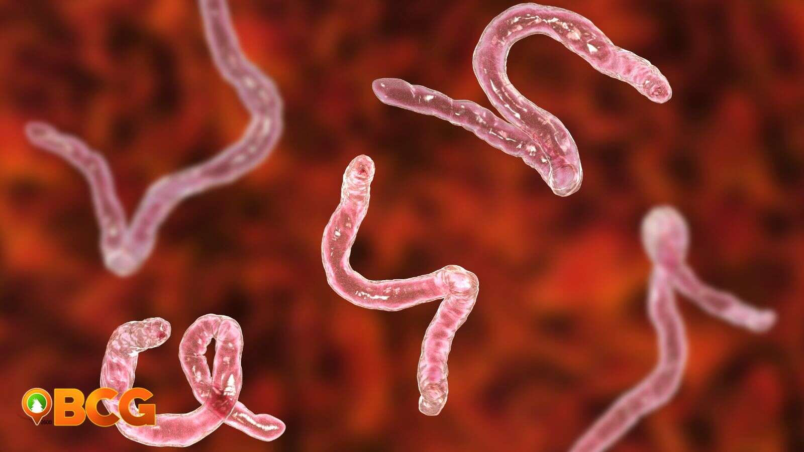 Finding a live brain worm is rare. 4 ways to protect yourself from more ...